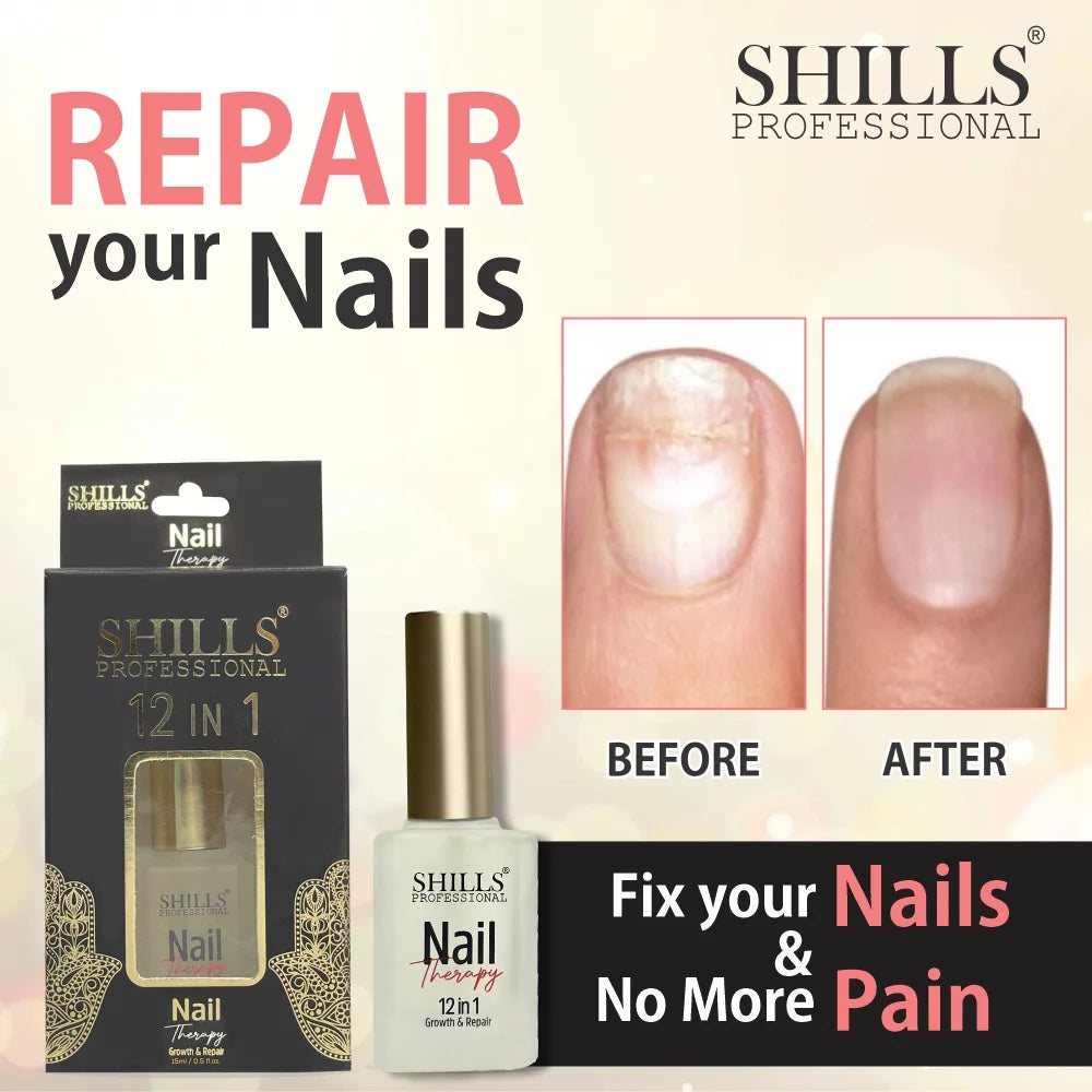 Shills Professional Nail Therapy 12 In 1 Growth & Repair 15ml – Beauty ...